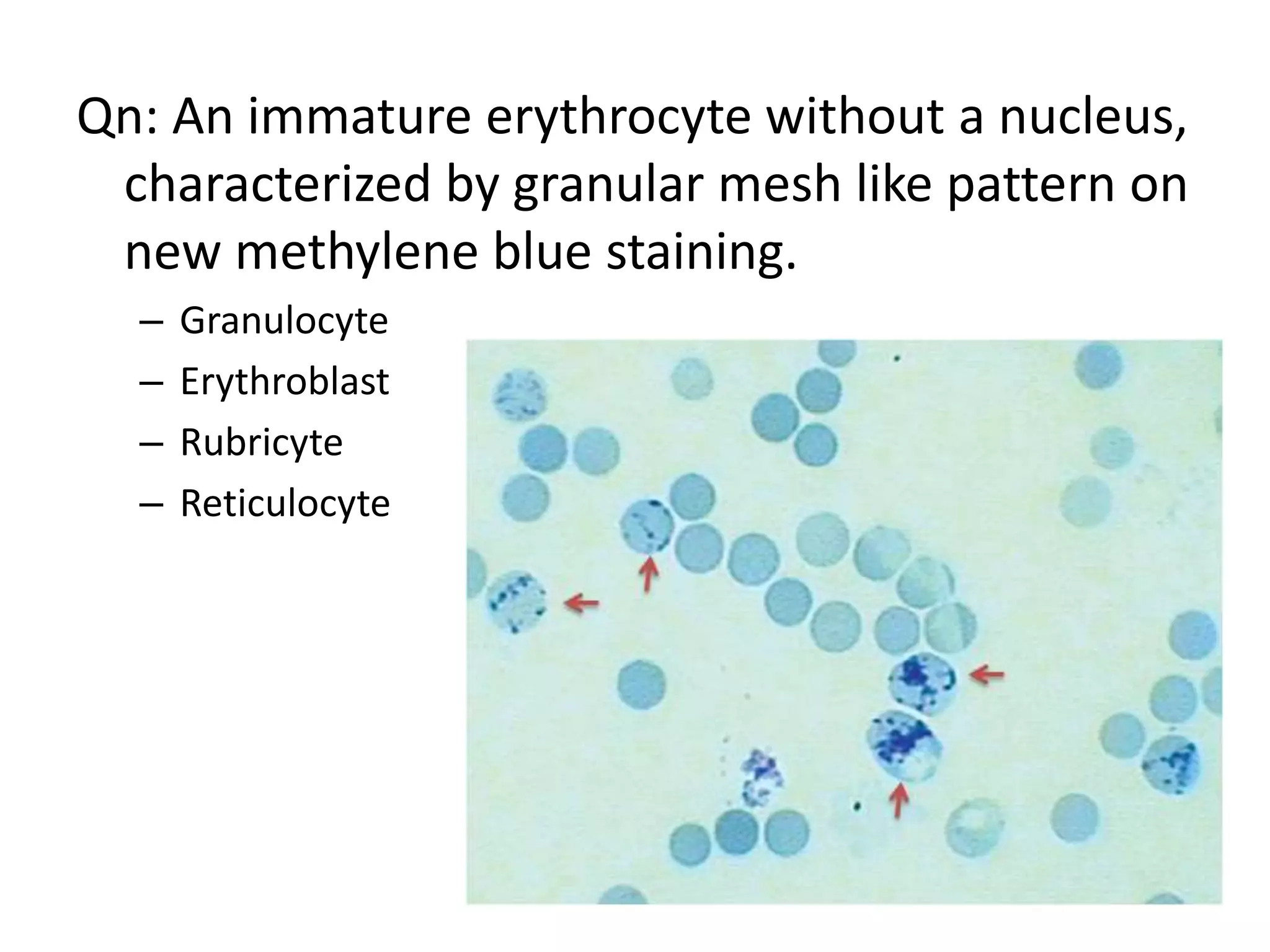 Diseases of haemopoietic, and lymphatic systems Part-II | PPTX