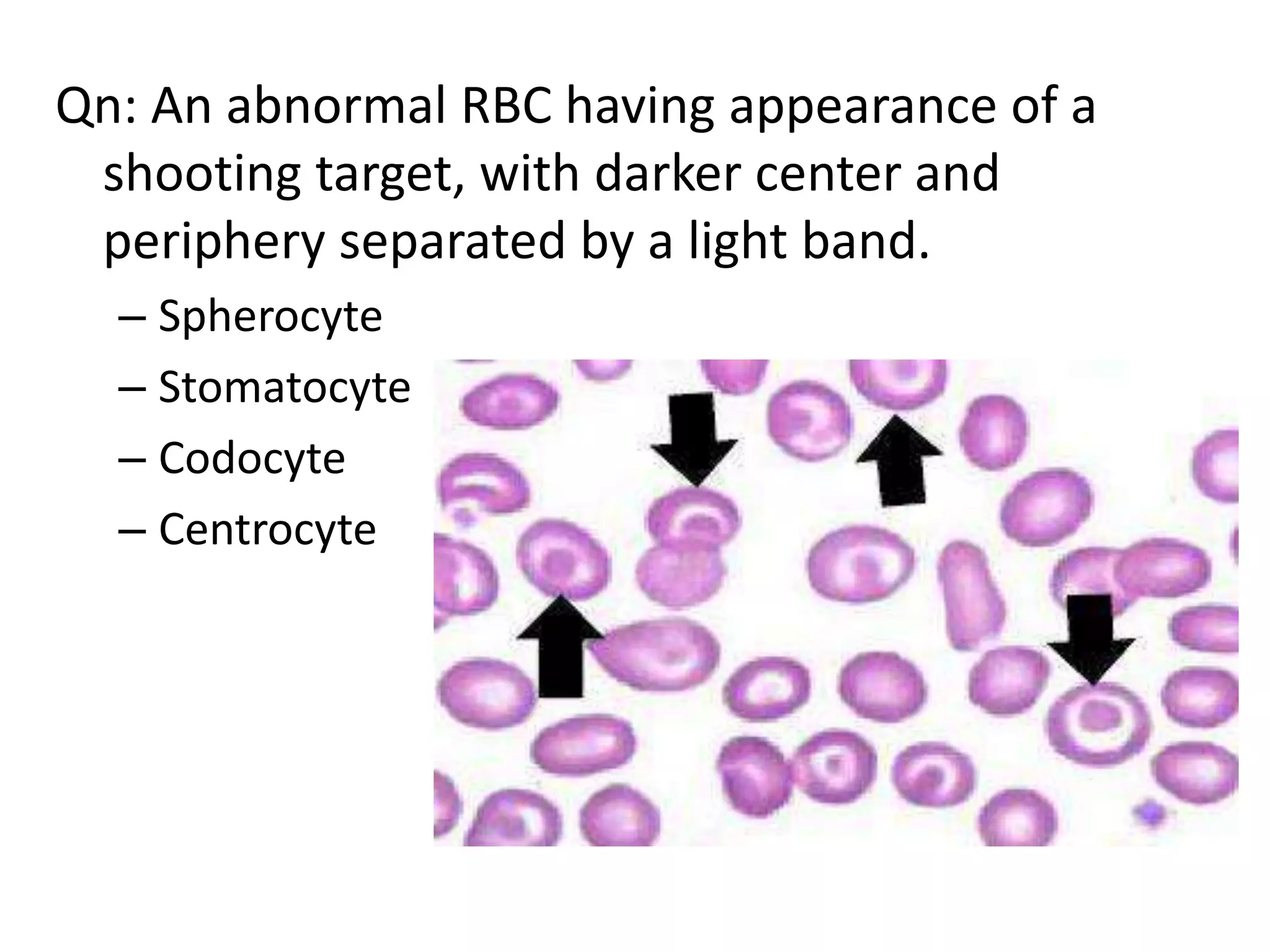 Diseases of haemopoietic, and lymphatic systems Part-II | PPTX