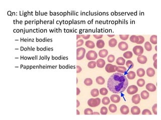 Diseases of haemopoietic, and lymphatic systems Part-II | PPT