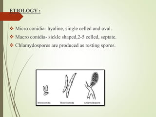 DISEASES OF ISABGOL PPT.pptx
