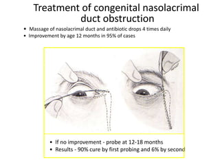 DISEASES OF LACRIMAL SYSTEM JKUAT.pptx