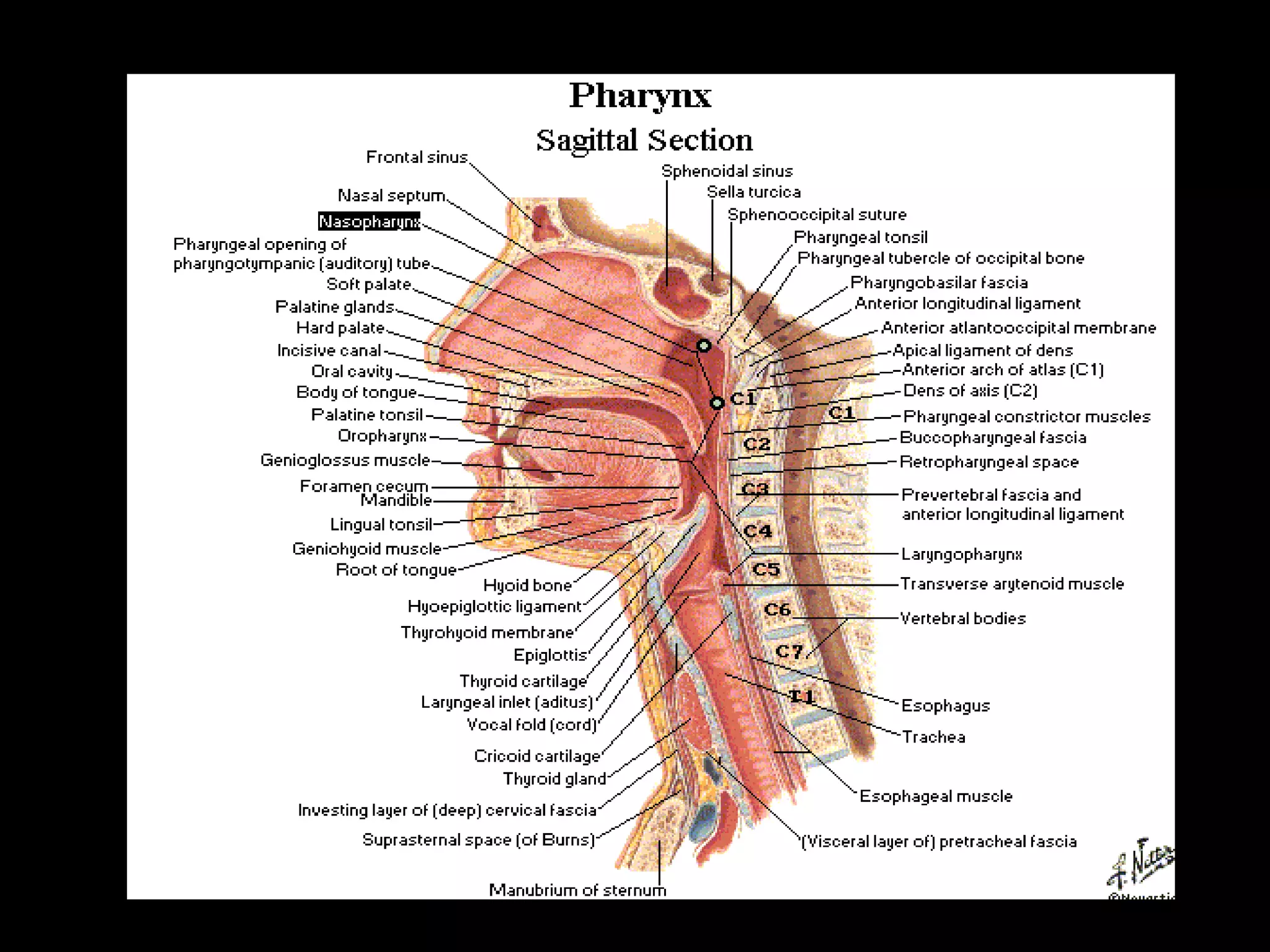 Diseases of larynx | PPTX