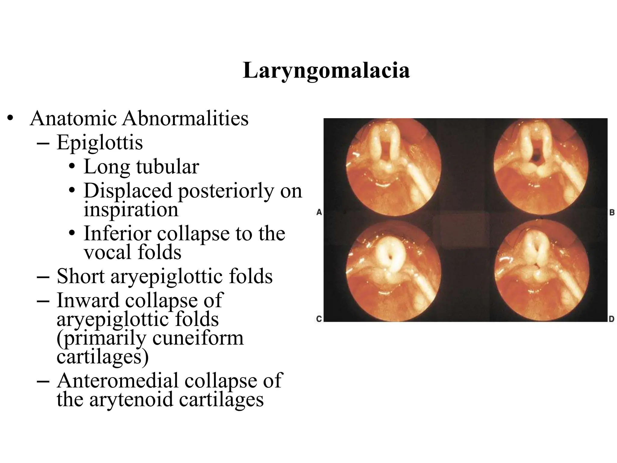 Diseases of Larynx.pptx