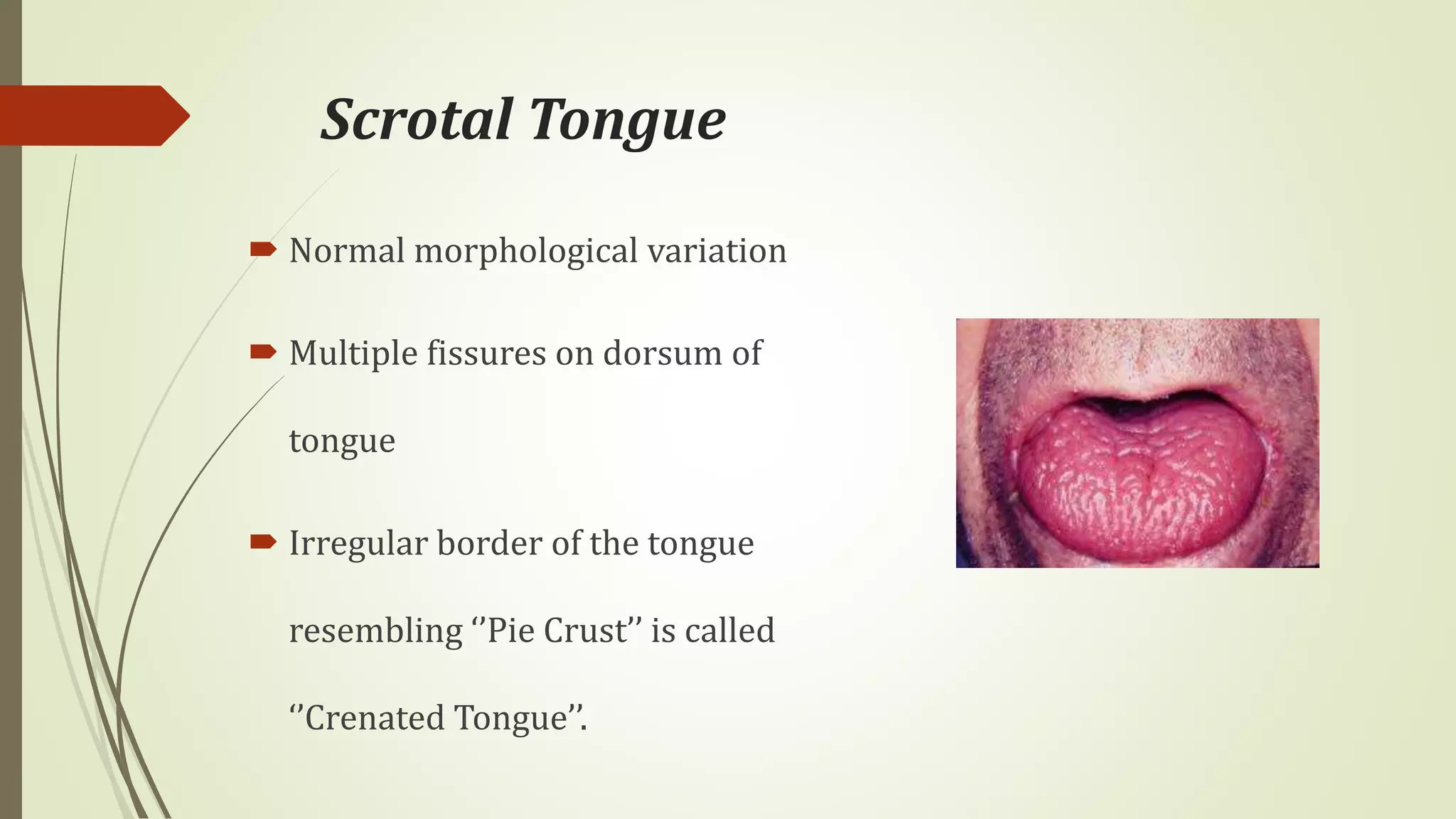Diseases of lips & tongue | PPTX