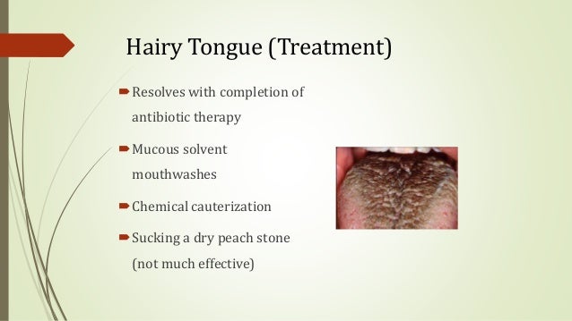 Diseases of lips & tongue