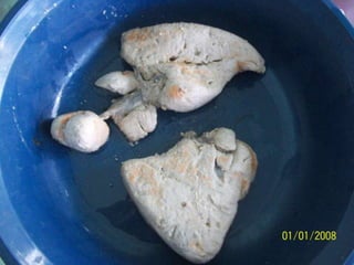 Diseases of liver and gall bladder | PPTX