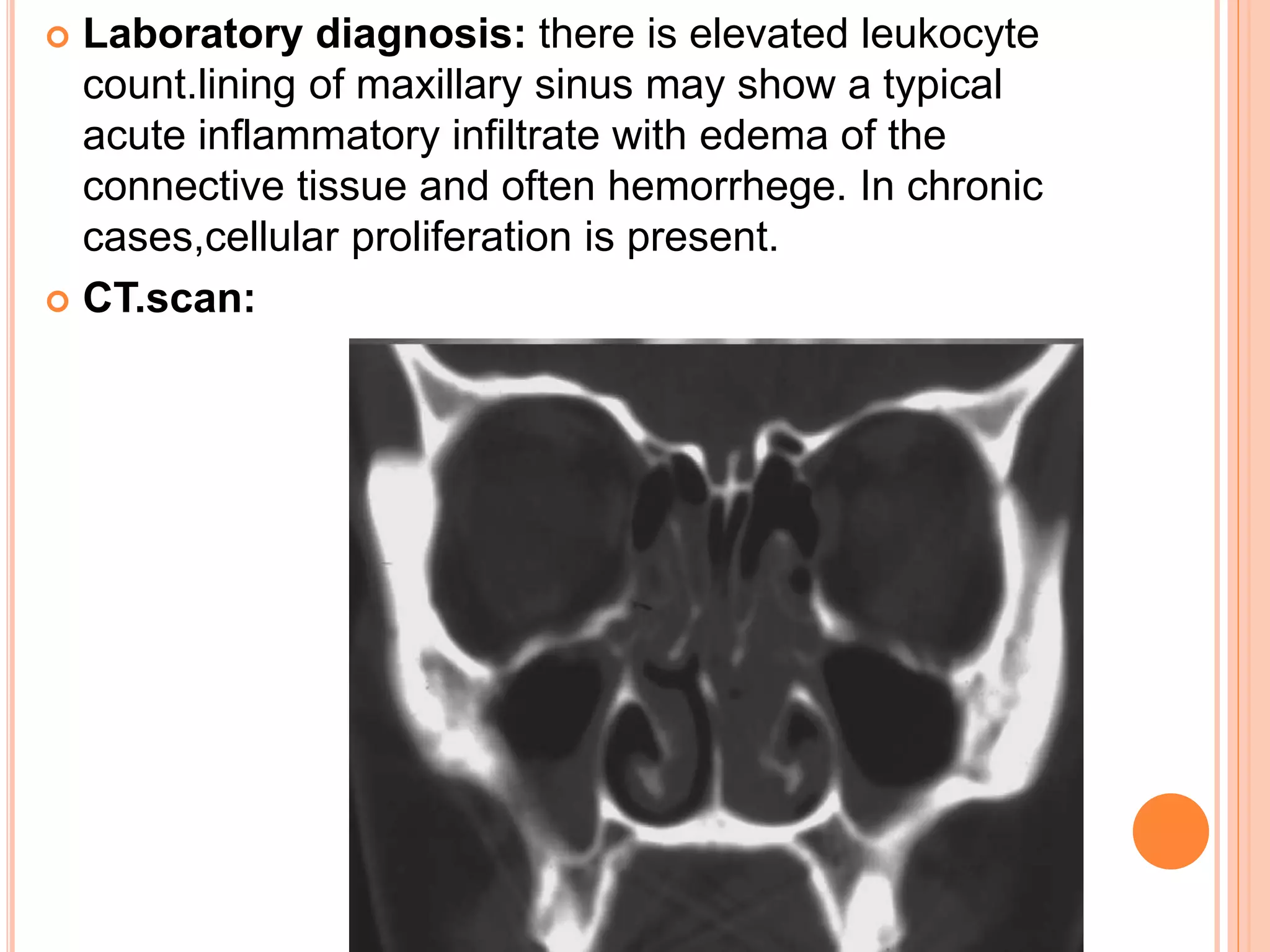 Diseases of maxillary sinus | PPTX