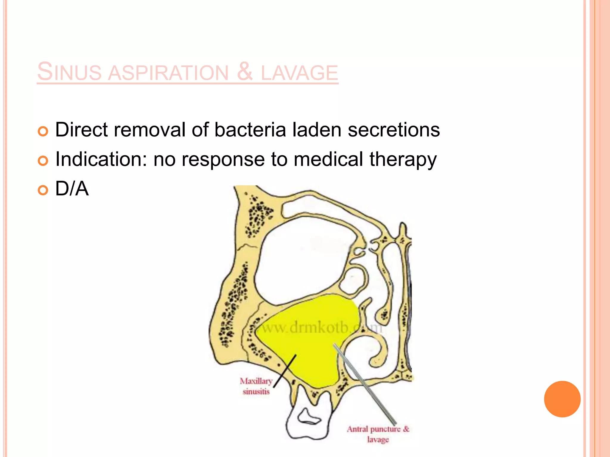 Diseases of maxillary sinus | PPTX