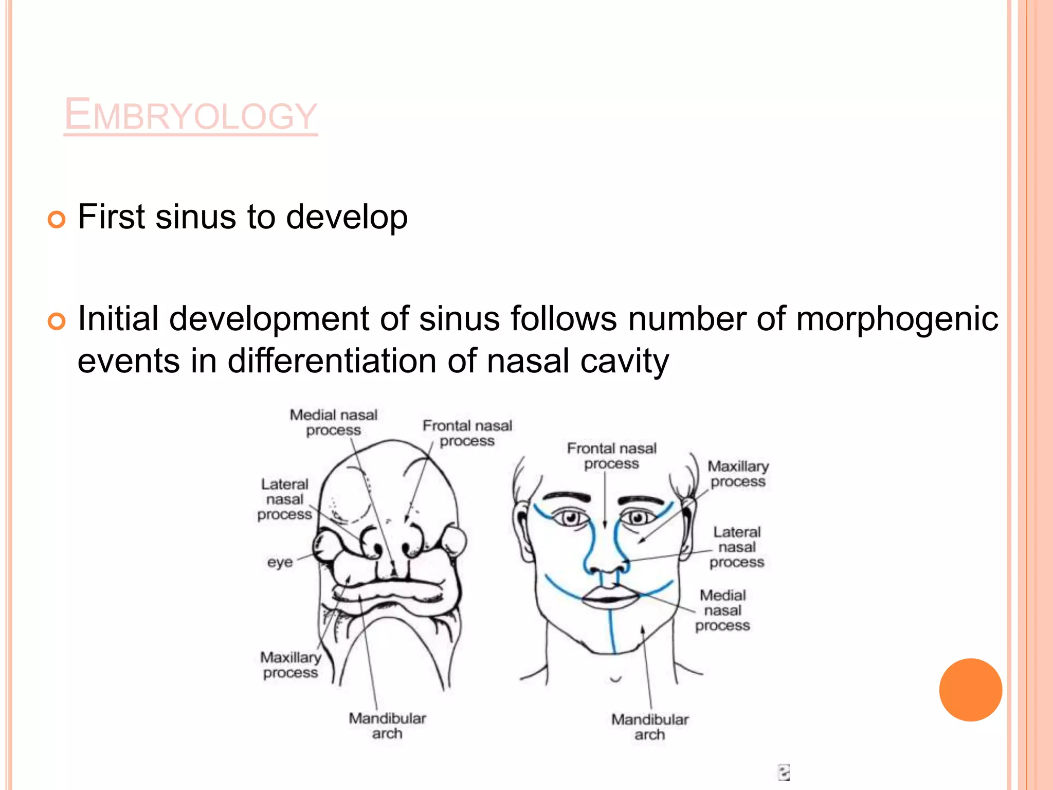 Diseases of maxillary sinus | PPTX