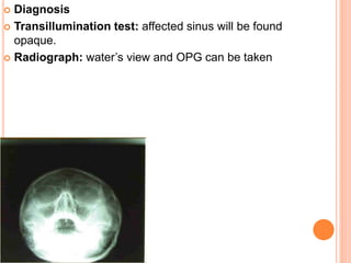 Diseases of maxillary sinus | PPTX