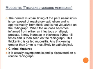 Diseases of maxillary sinus | PPTX