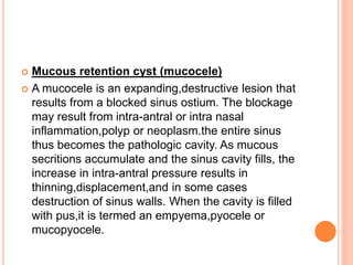 Diseases of maxillary sinus | PPTX