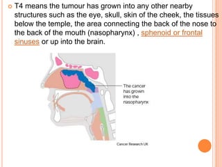 Diseases of maxillary sinus | PPT