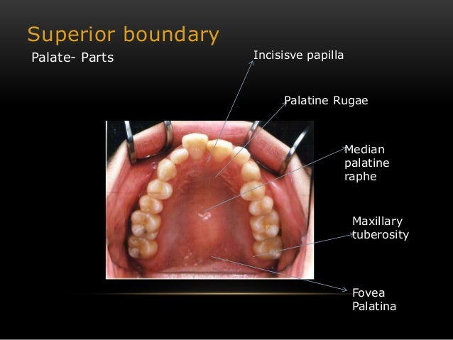Diseases of mouth, palate, lips & cheek