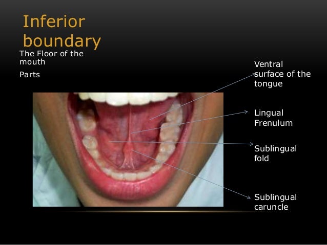 Diseases of mouth, palate, lips & cheek
