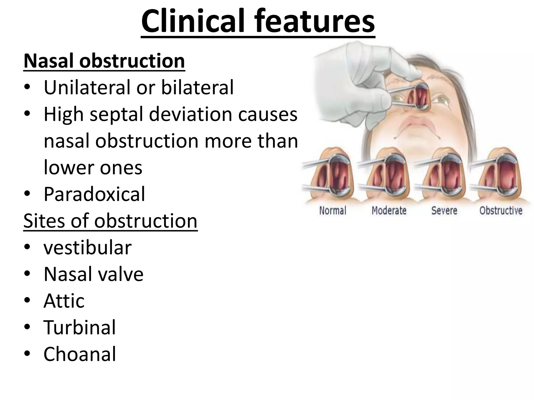 Diseases of nasal septum | PPTX