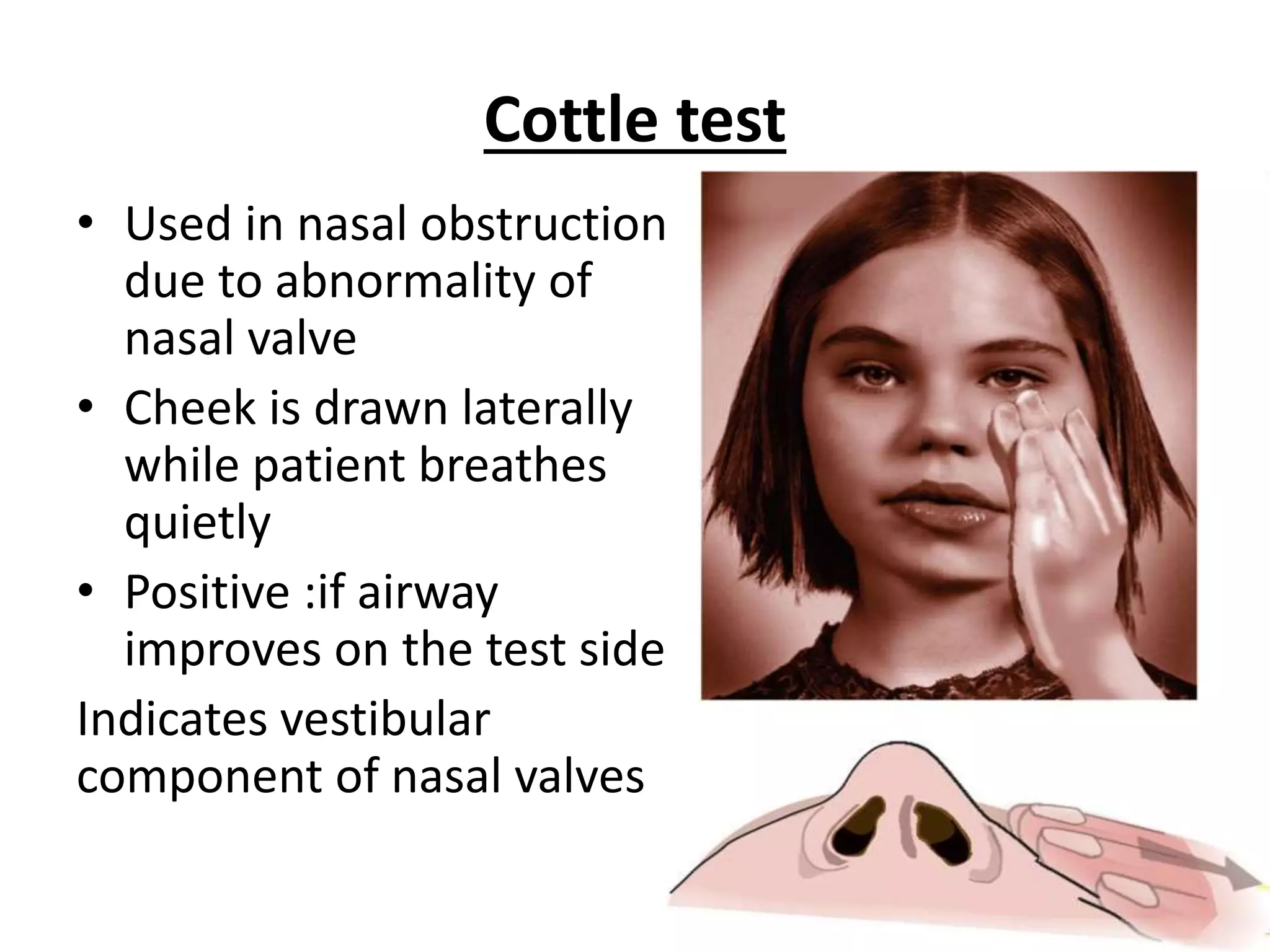 Diseases of nasal septum | PPTX