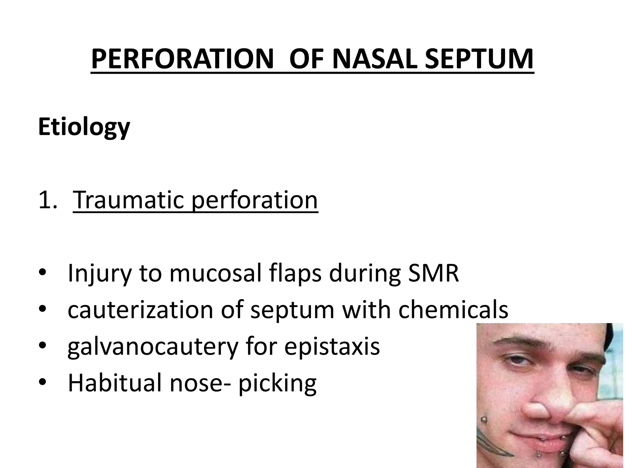 Diseases of nasal septum | PPTX