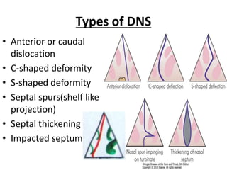 Diseases of nasal septum | PPTX