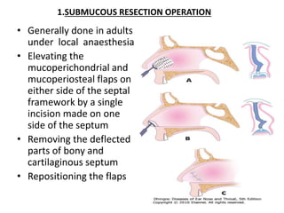 Diseases of nasal septum | PPTX