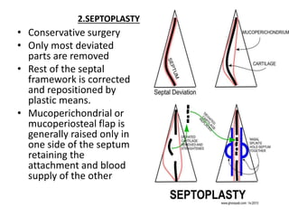 Diseases of nasal septum | PPTX