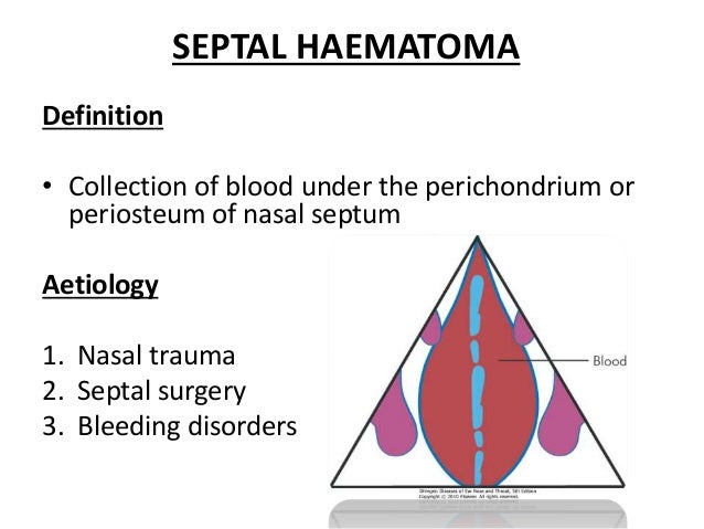 Diseases of nasal septum