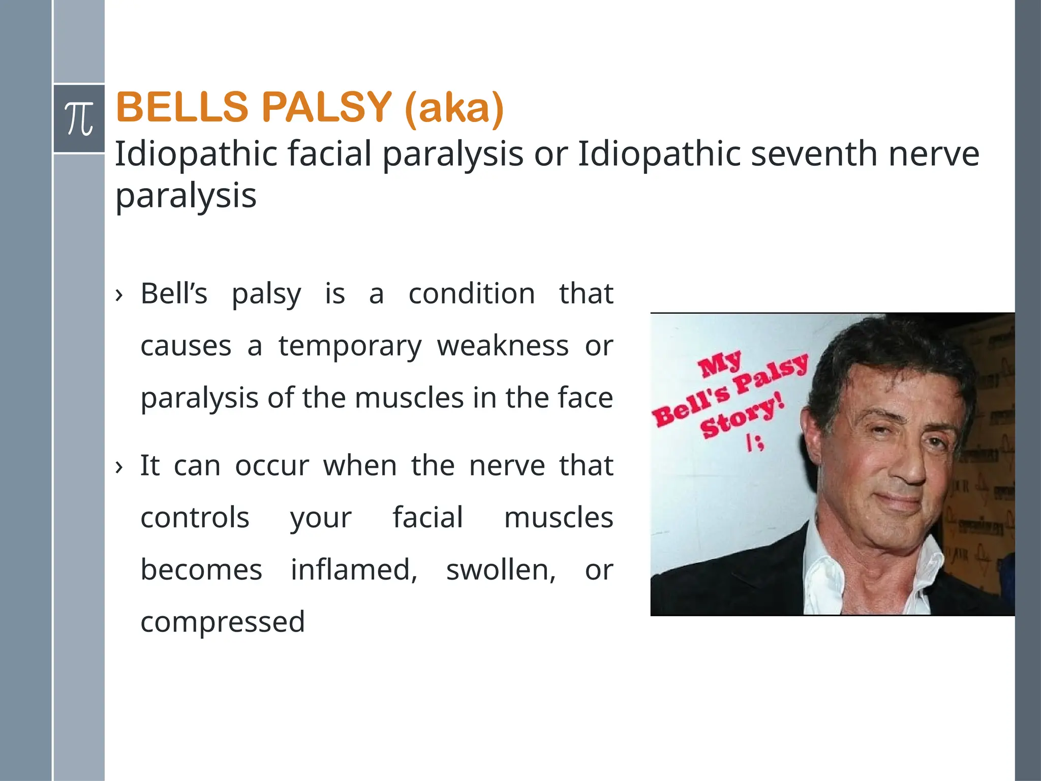 DISEASES OF NERVE oral patholgy hsa.pptx