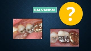 diseases related to nerves and muscles.ppt x | PPT