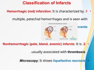 Diseases of Nervous system EncephCEREBROVASCULAR DISEASESalitis | PPT