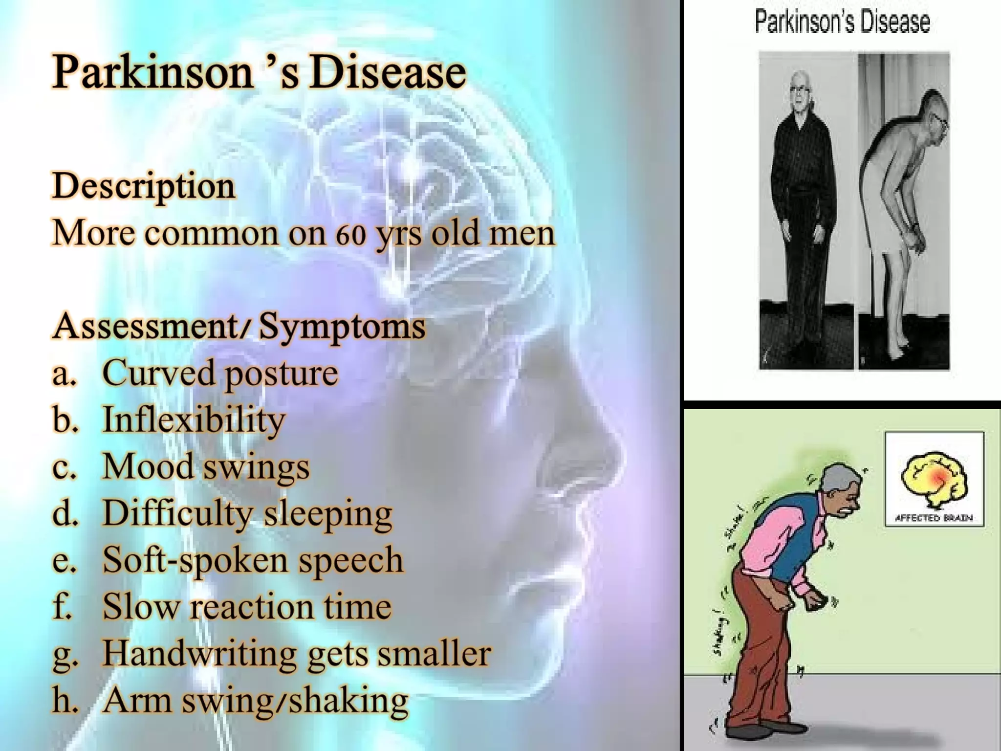 Diseases of nervous system | PPT