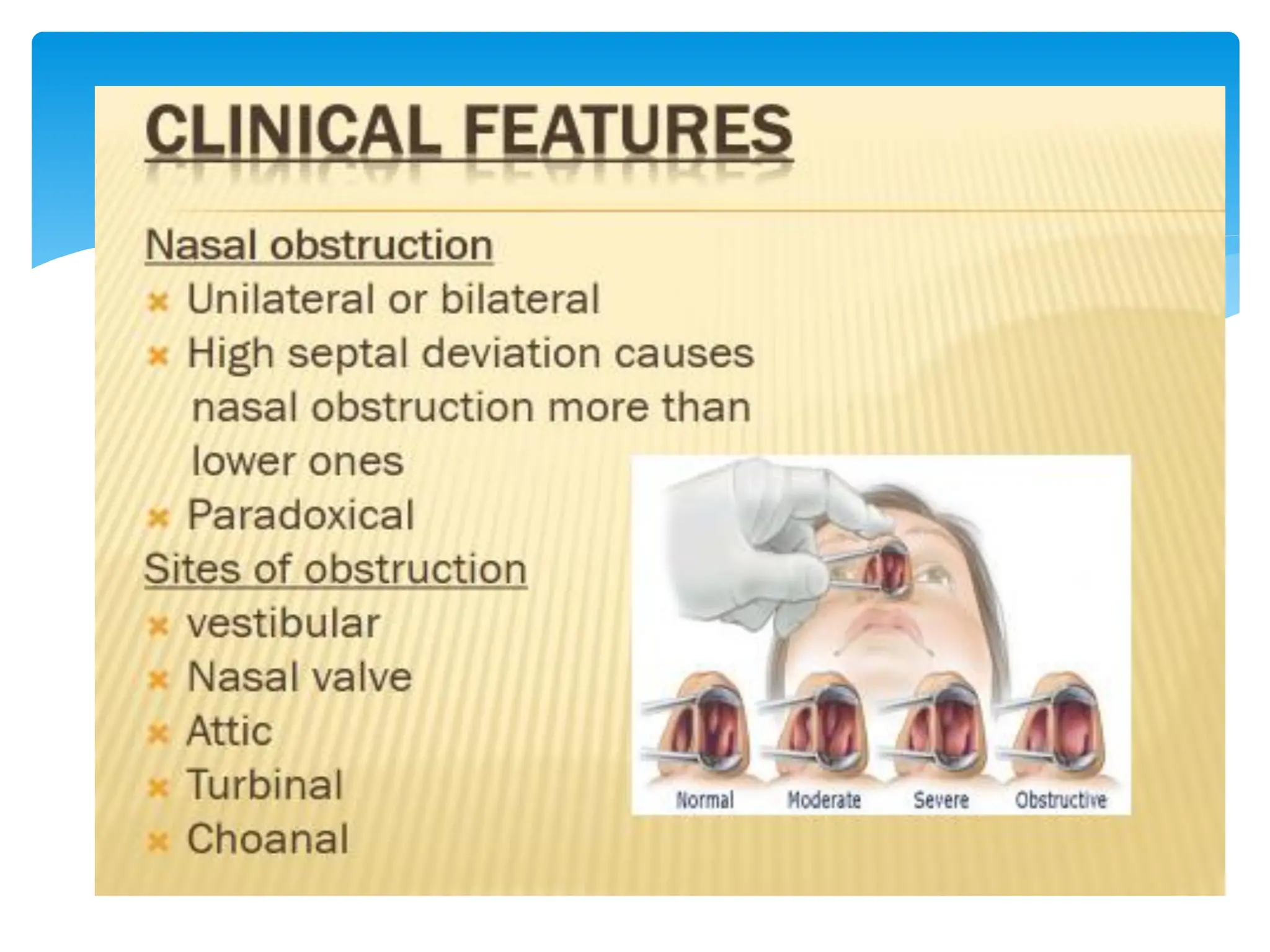 Diseases of nose and paranasal sinuses.pdf