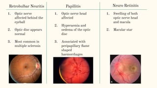 Diseases of optic nerve and it's clinical aspects .pdf