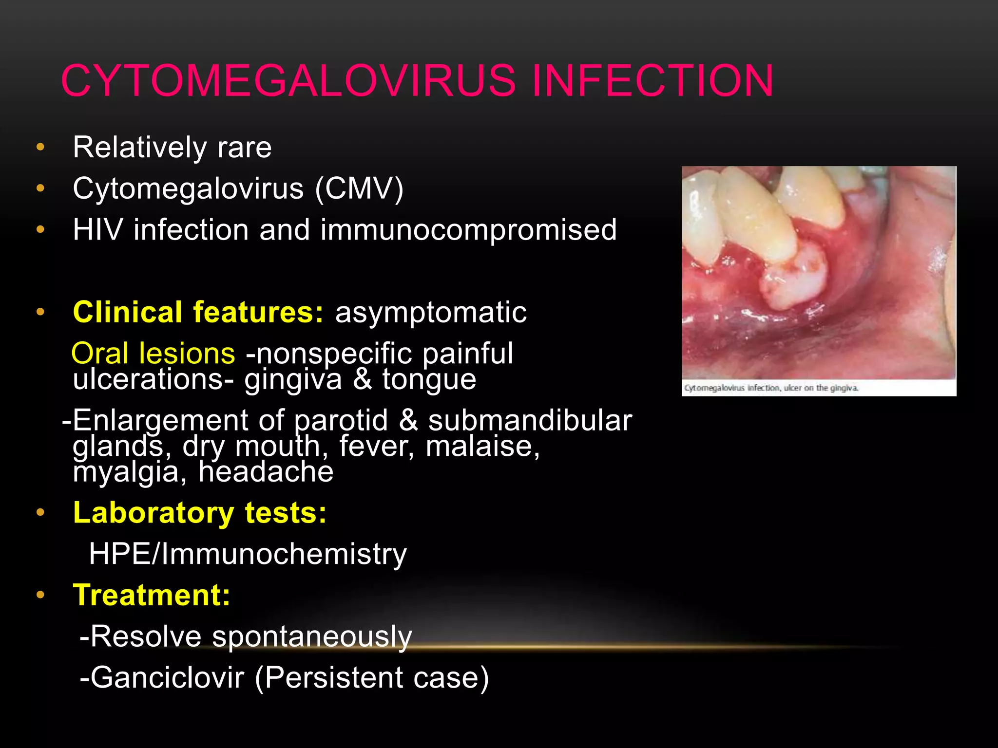 Diseases of oral cavity | PPTX