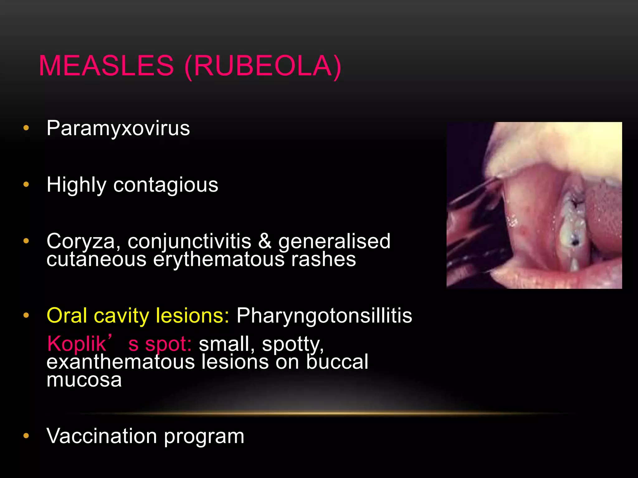 Diseases of oral cavity | PPTX