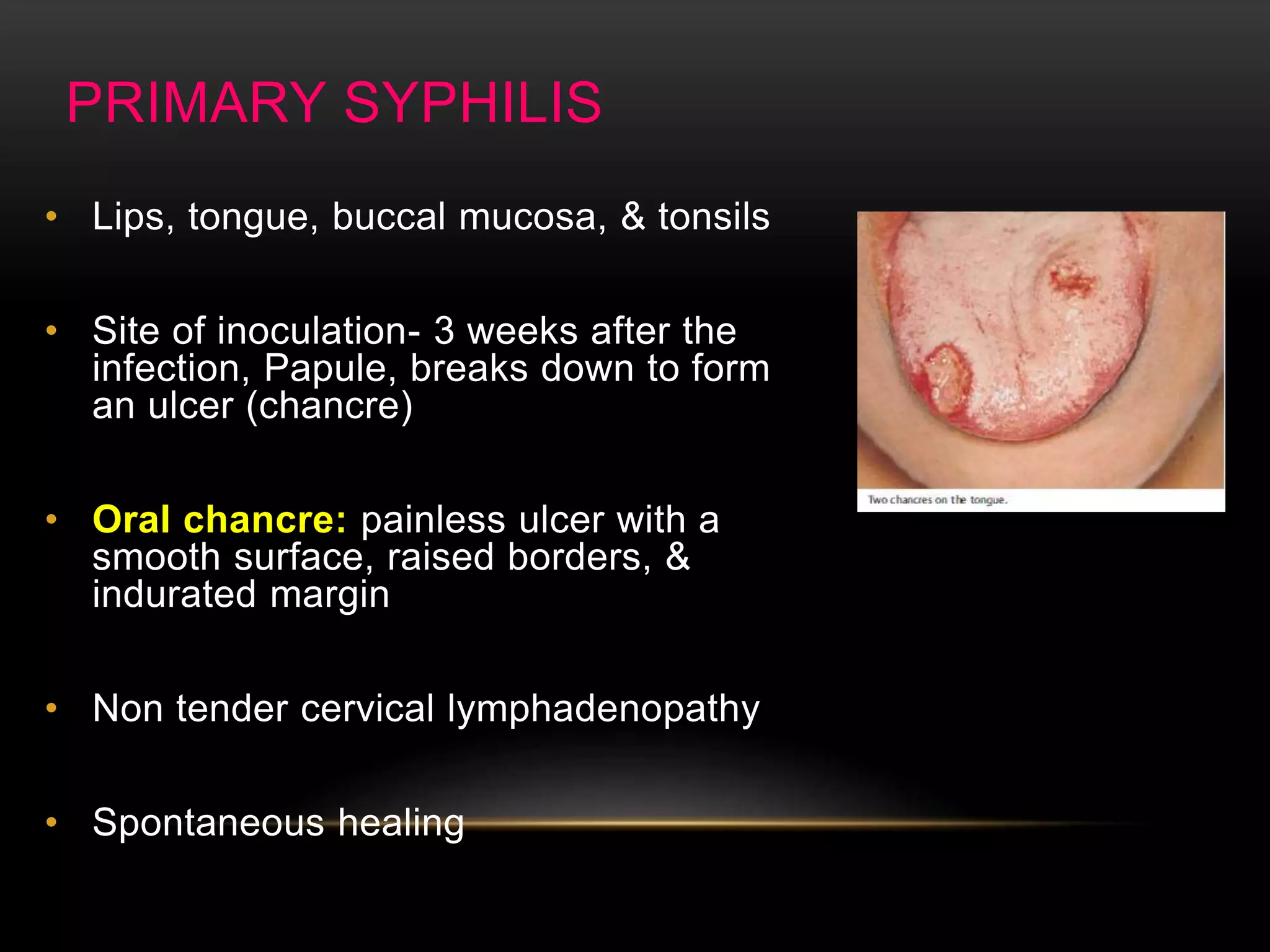 Diseases of oral cavity | PPTX