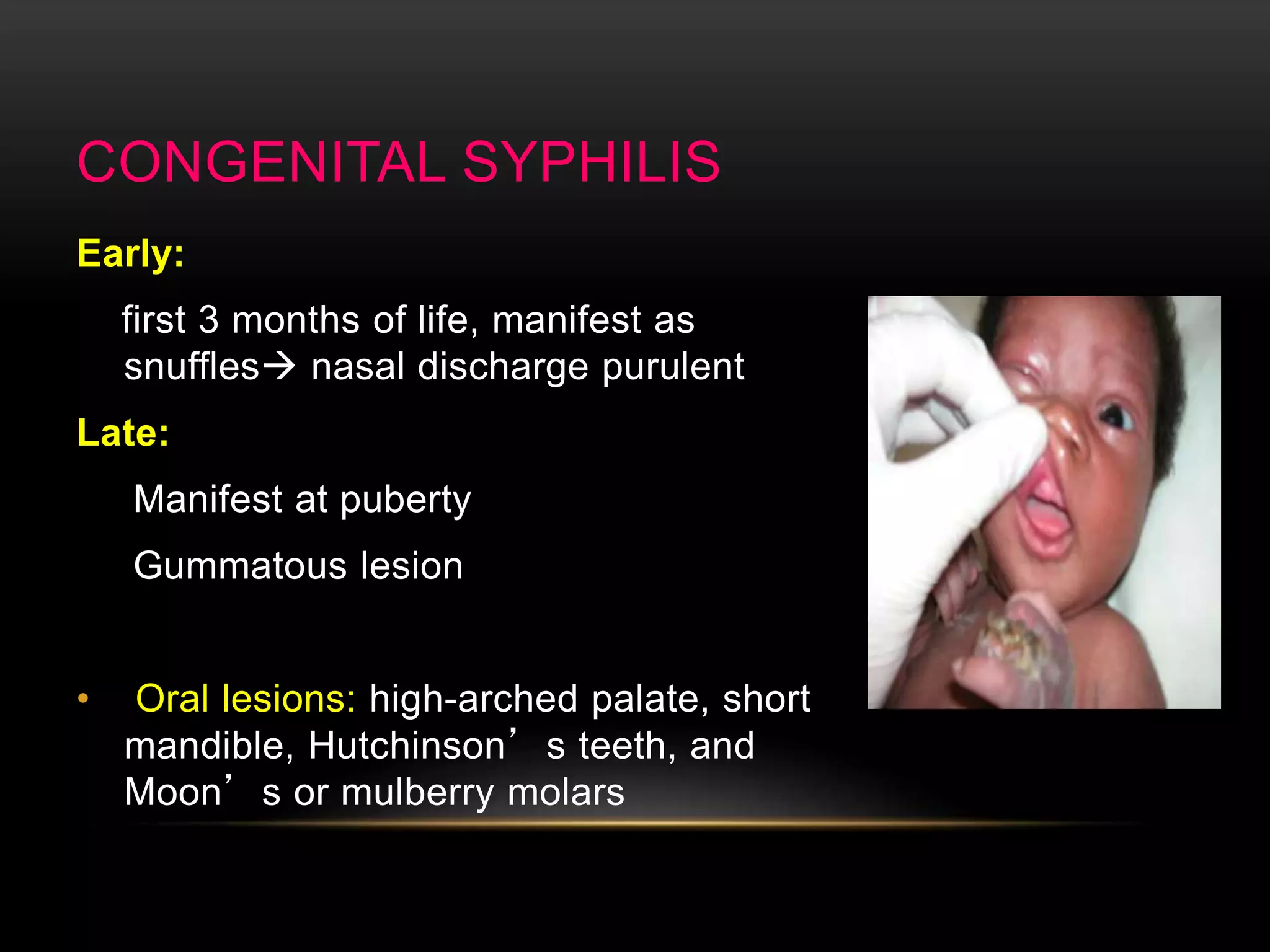 Diseases of oral cavity | PPTX