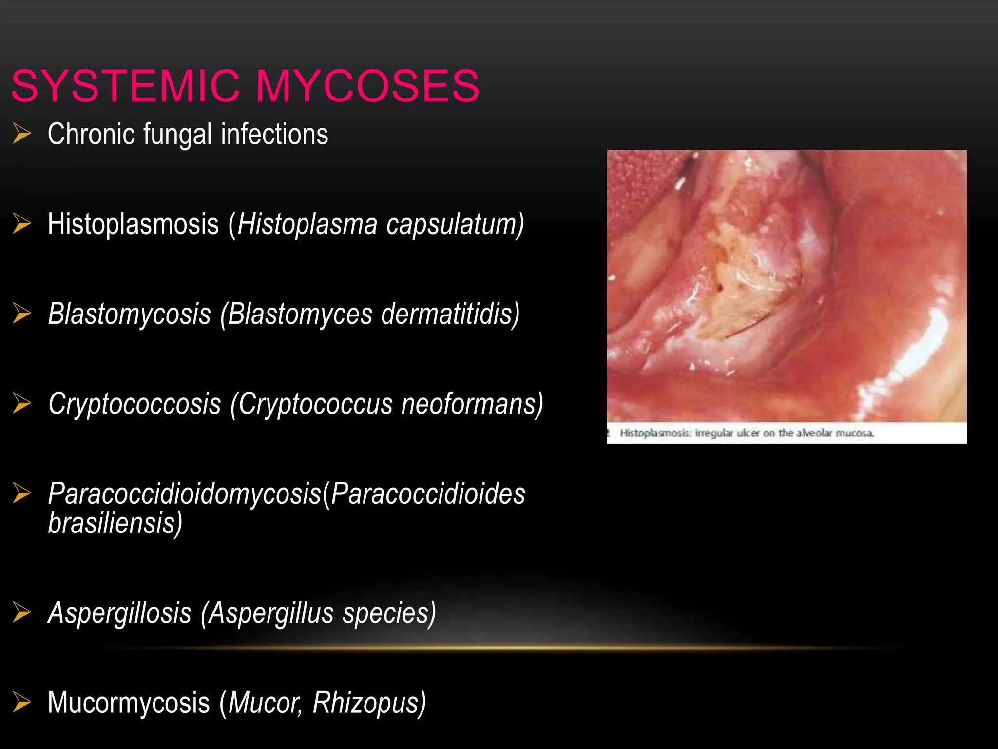 Diseases of oral cavity | PPTX
