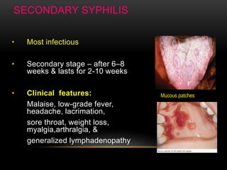 Diseases of oral cavity | PPTX