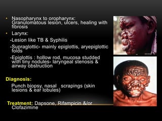 Diseases of oral cavity | PPTX