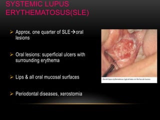 Diseases of oral cavity | PPTX