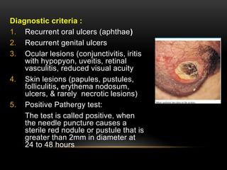 Diseases of oral cavity | PPTX