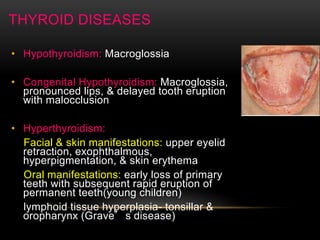 Diseases of oral cavity | PPTX
