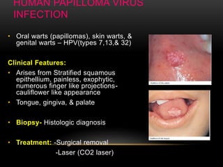 Diseases of oral cavity | PPTX