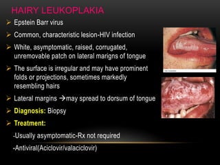 Diseases of oral cavity | PPTX