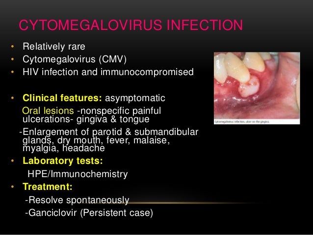 Diseases of oral cavity