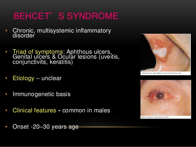 Diseases of oral cavity