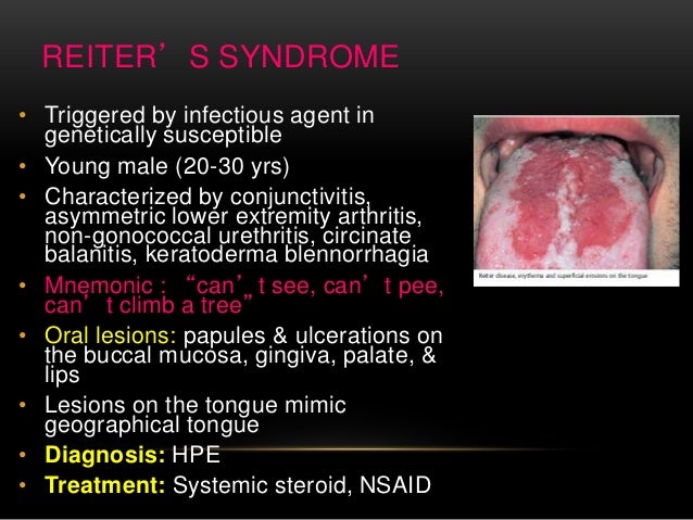 Diseases of oral cavity