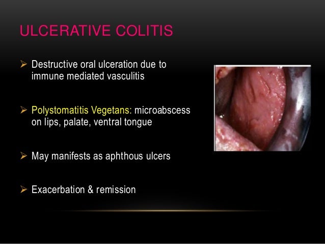 Diseases of oral cavity