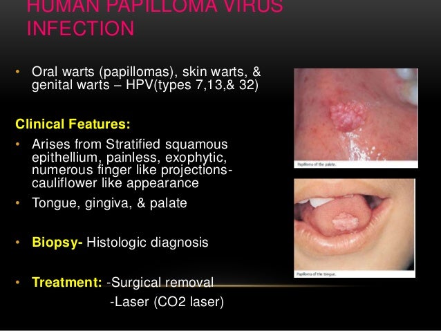 Diseases of oral cavity
