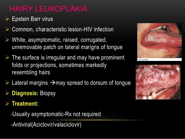 Diseases of oral cavity